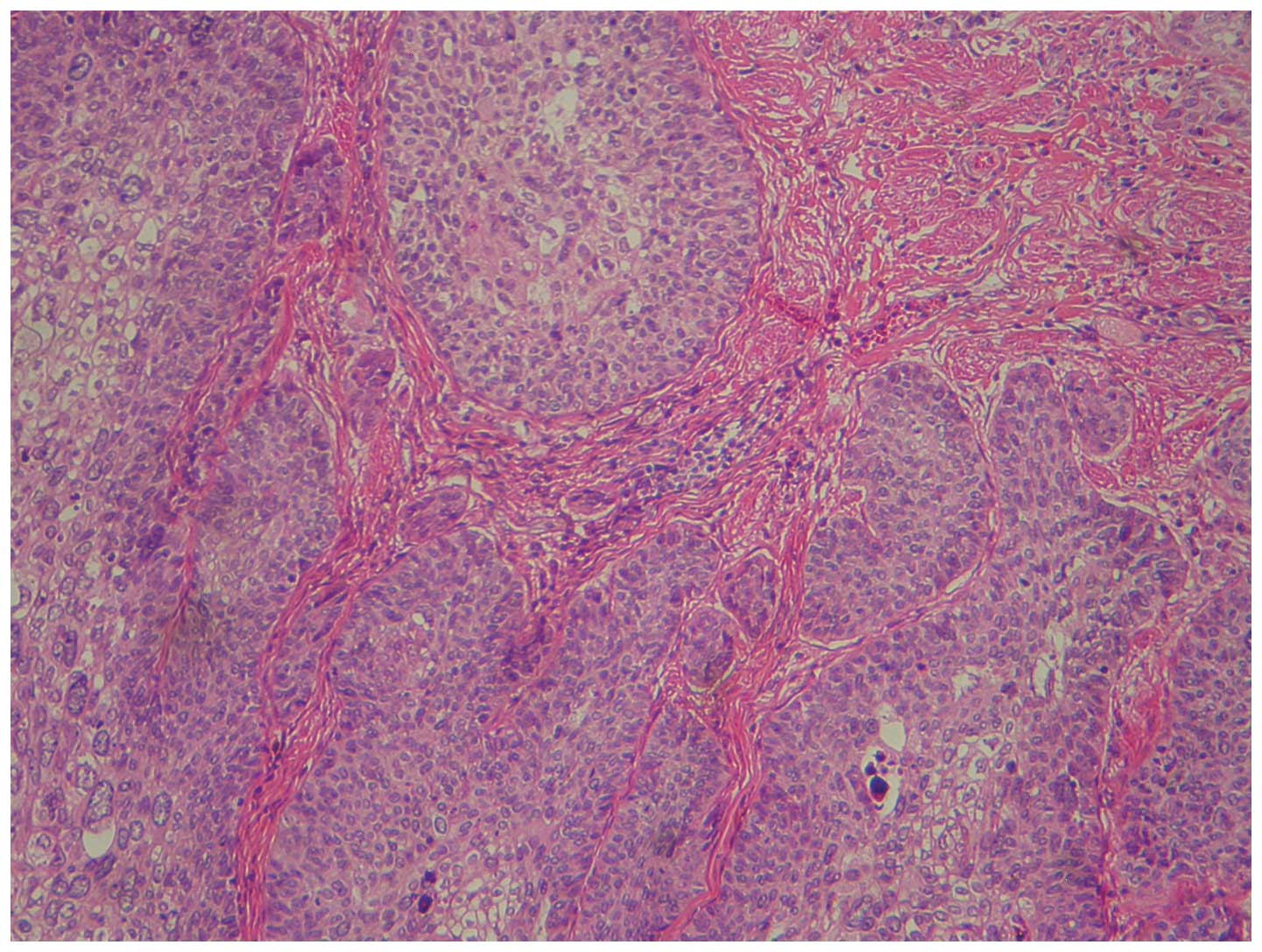Icd 10 Code For Cheek Mass Icd 10 Code For Cheek Mass