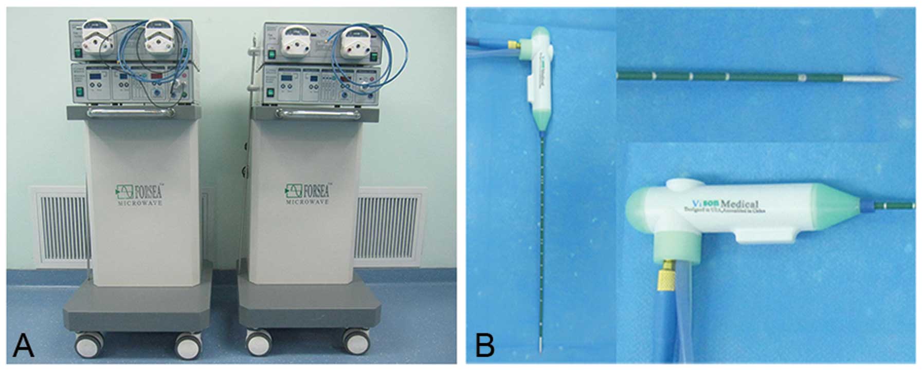 Microwave tissue coagulation technique in anatomical liver resection