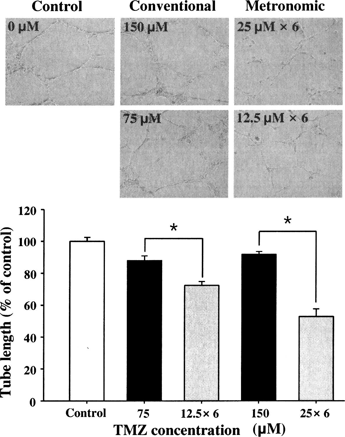 Metronomic treatment of temozolomide increases anti-angiogenicity ...