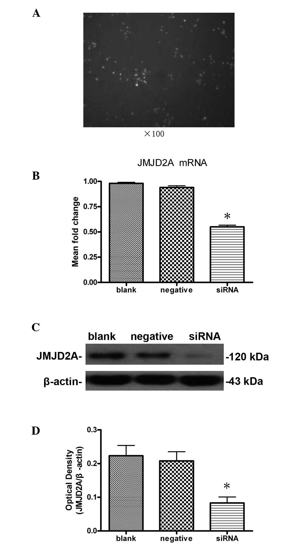 Effects of siRNA-mediated knockdown of jumonji domain containing 2A on ...