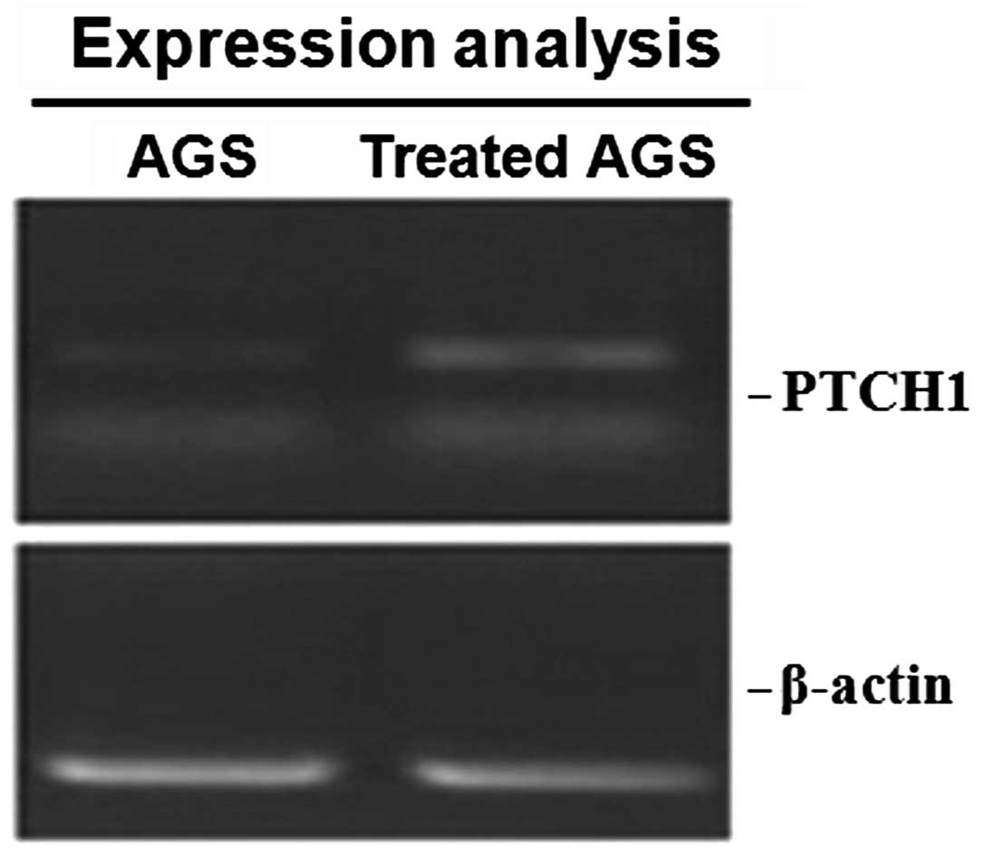 Detection and analysis of the methylation status of PTCH1 gene involved ...