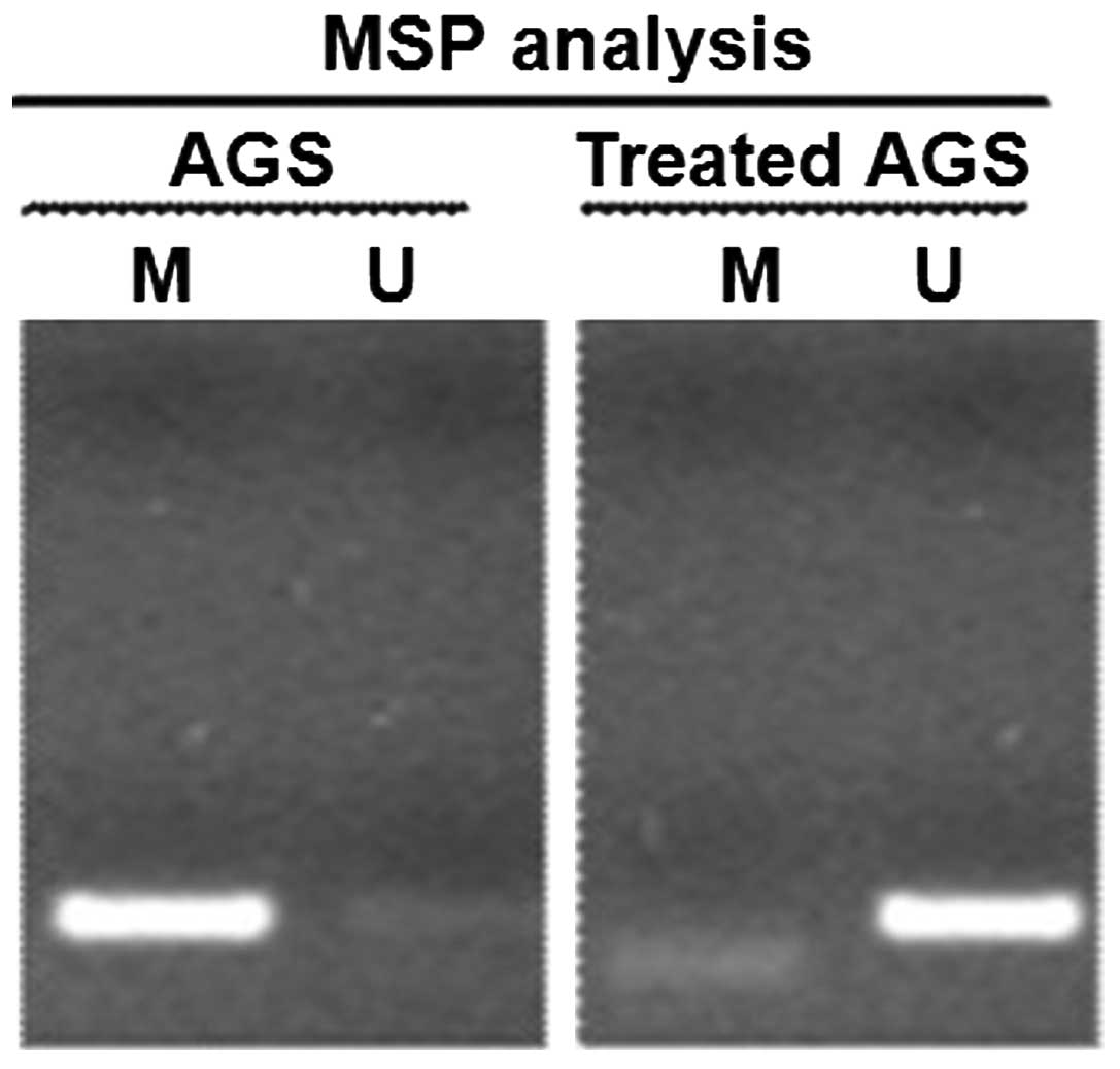 Detection and analysis of the methylation status of PTCH1 gene involved ...
