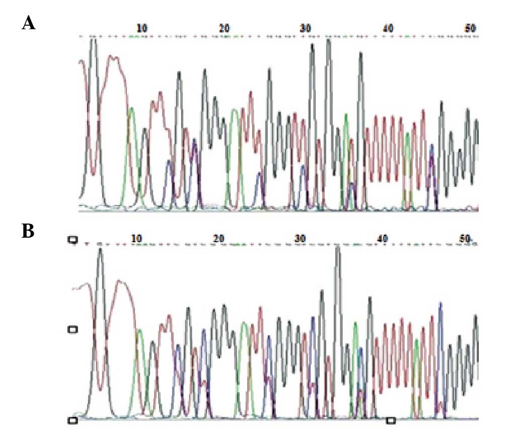 Detection and analysis of the methylation status of PTCH1 gene involved ...