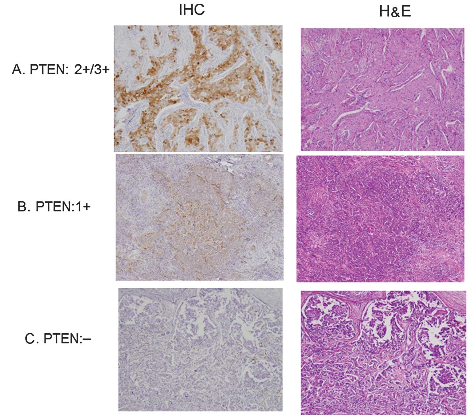 Evaluation of PTEN loss and PIK3CA mutations and their correlation with ...