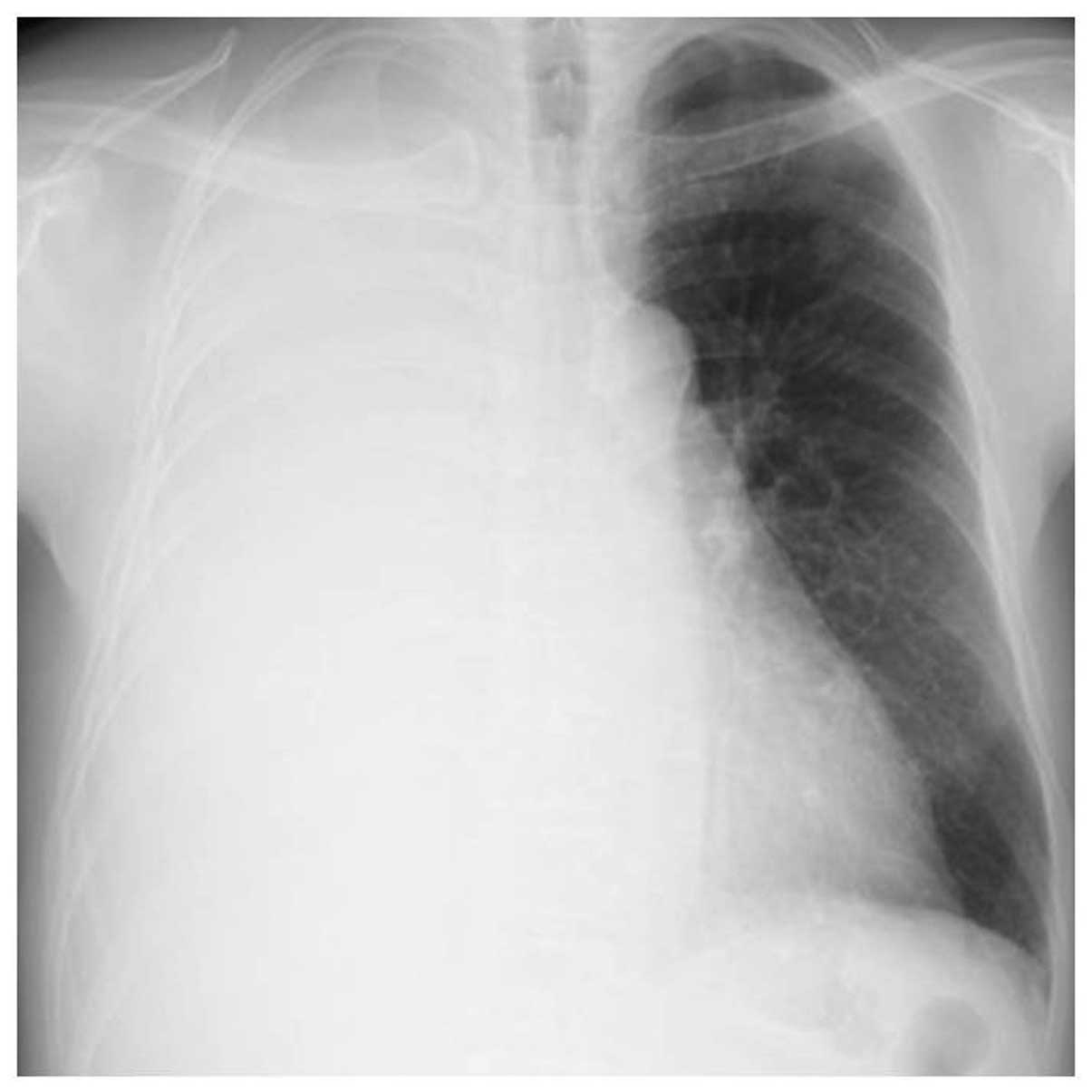 Molecular and Clinical Oncology