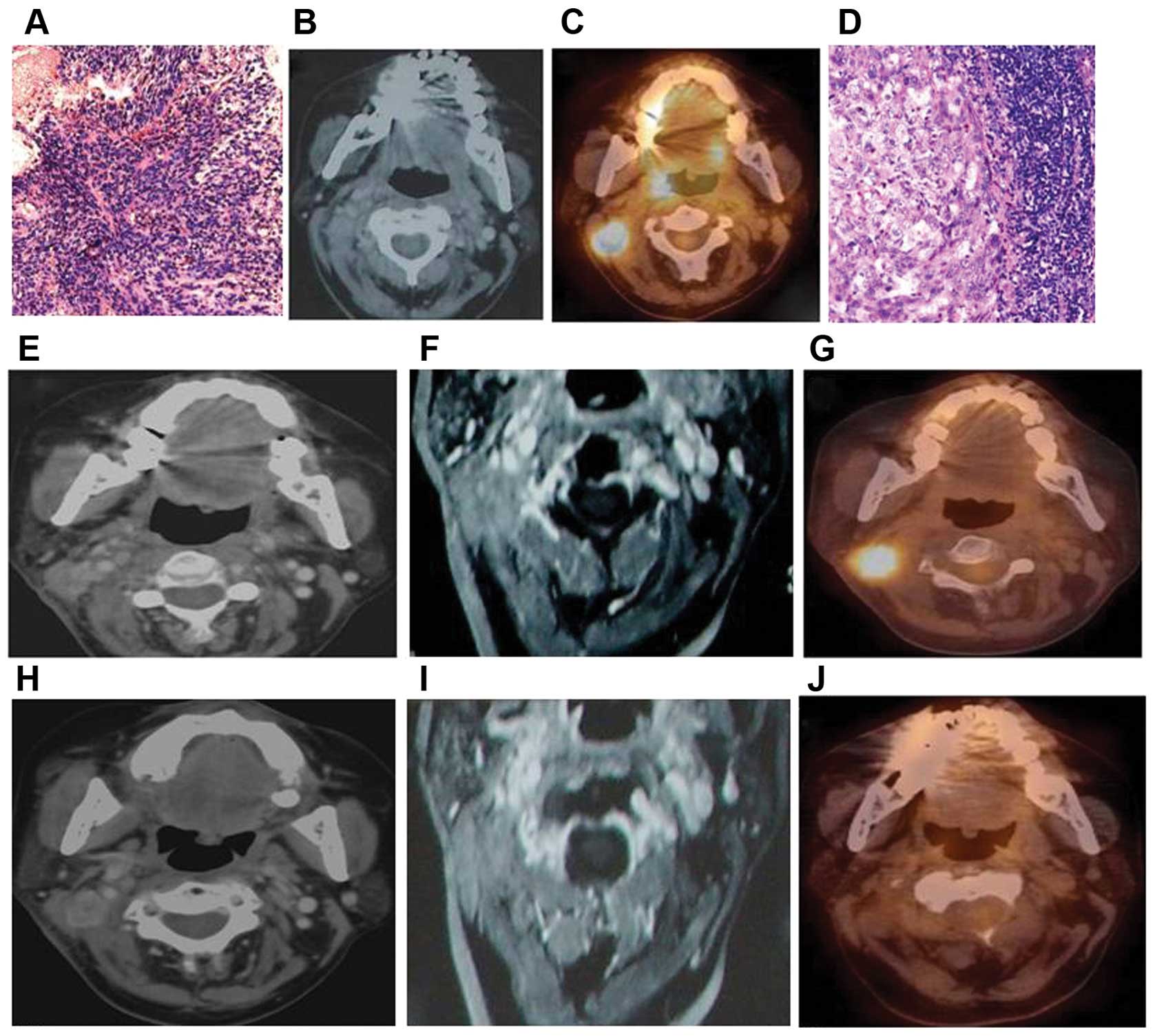 Molecular and Clinical Oncology