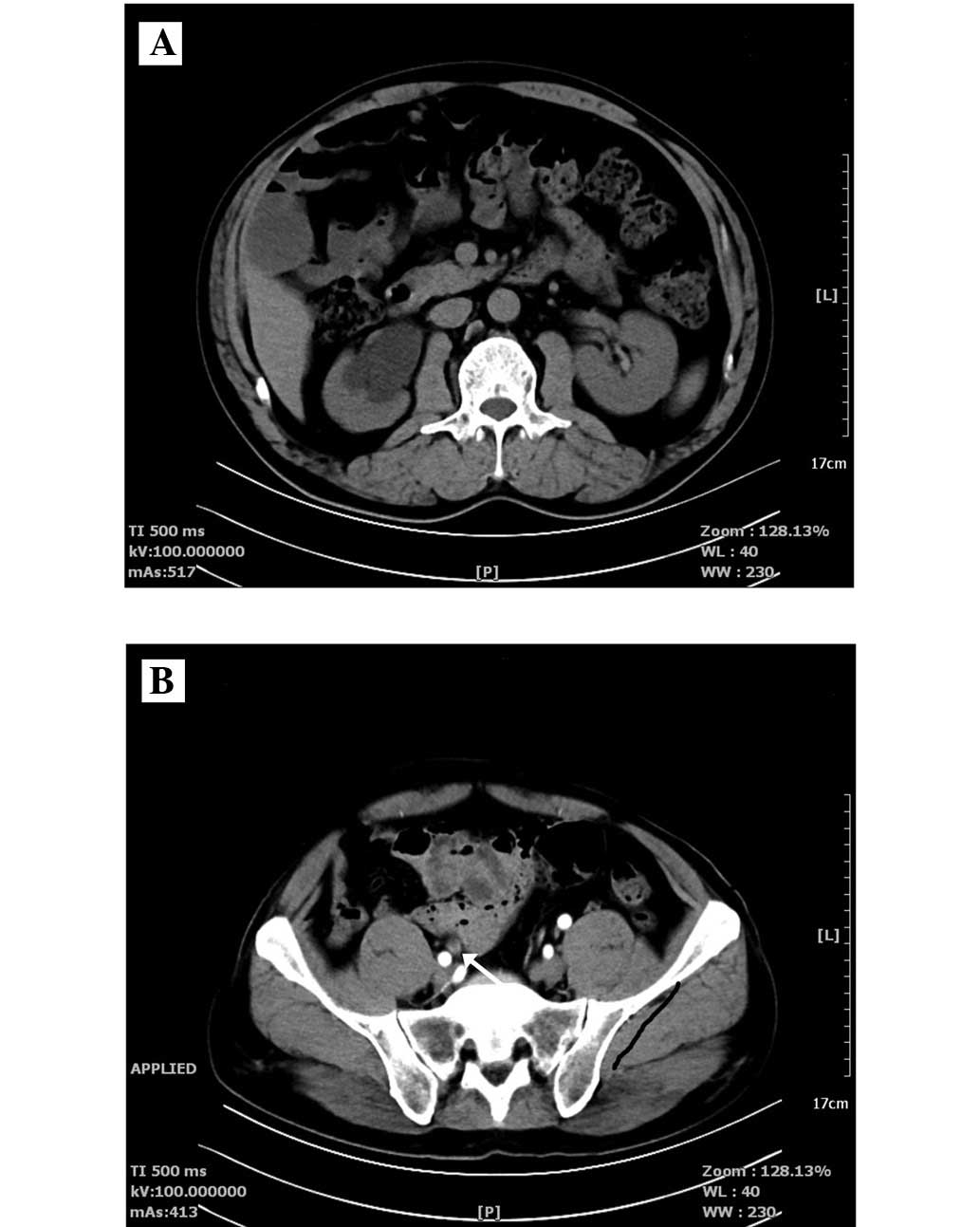 Molecular and Clinical Oncology