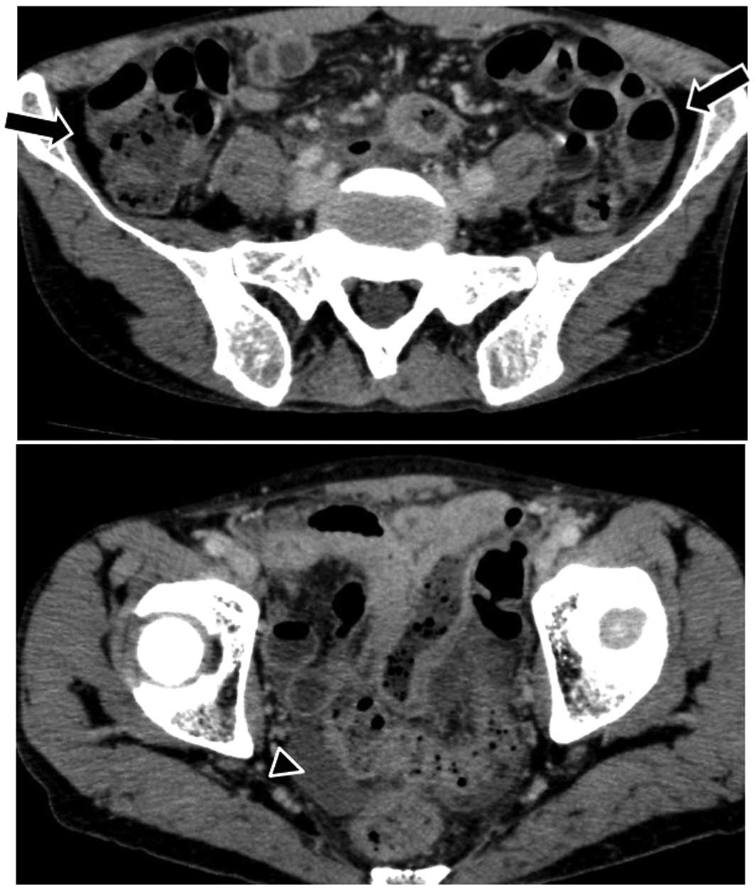 Molecular and Clinical Oncology