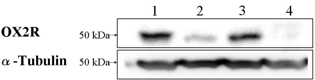 Orexin 2 receptor as a potential target for immunotoxin and antibody ...