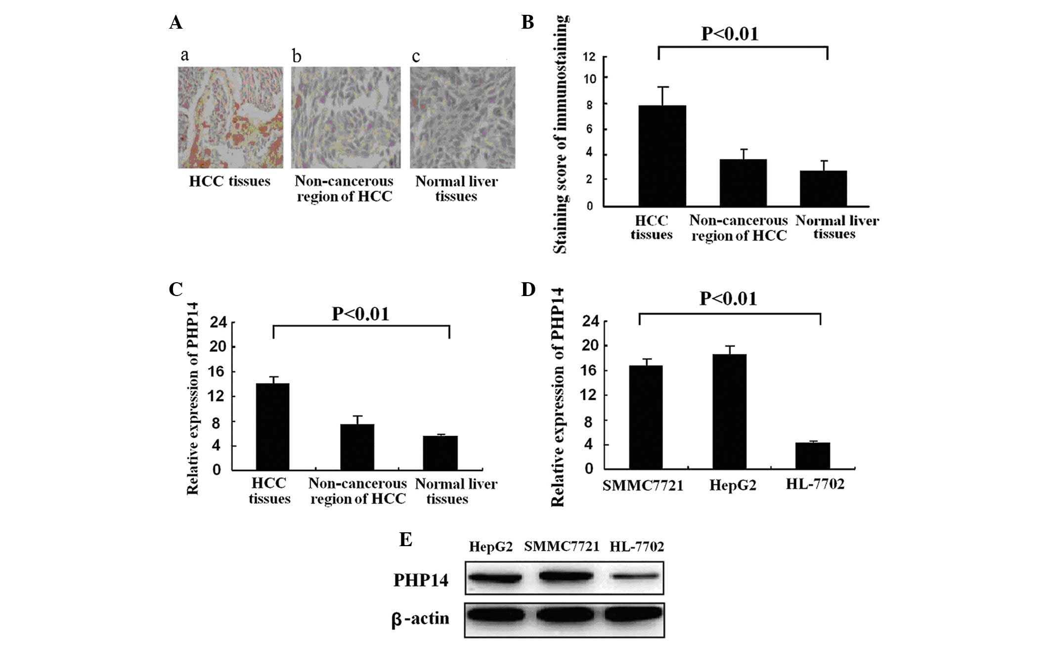 14‑kDa Phosphohistidine phosphatase plays an important role in ...