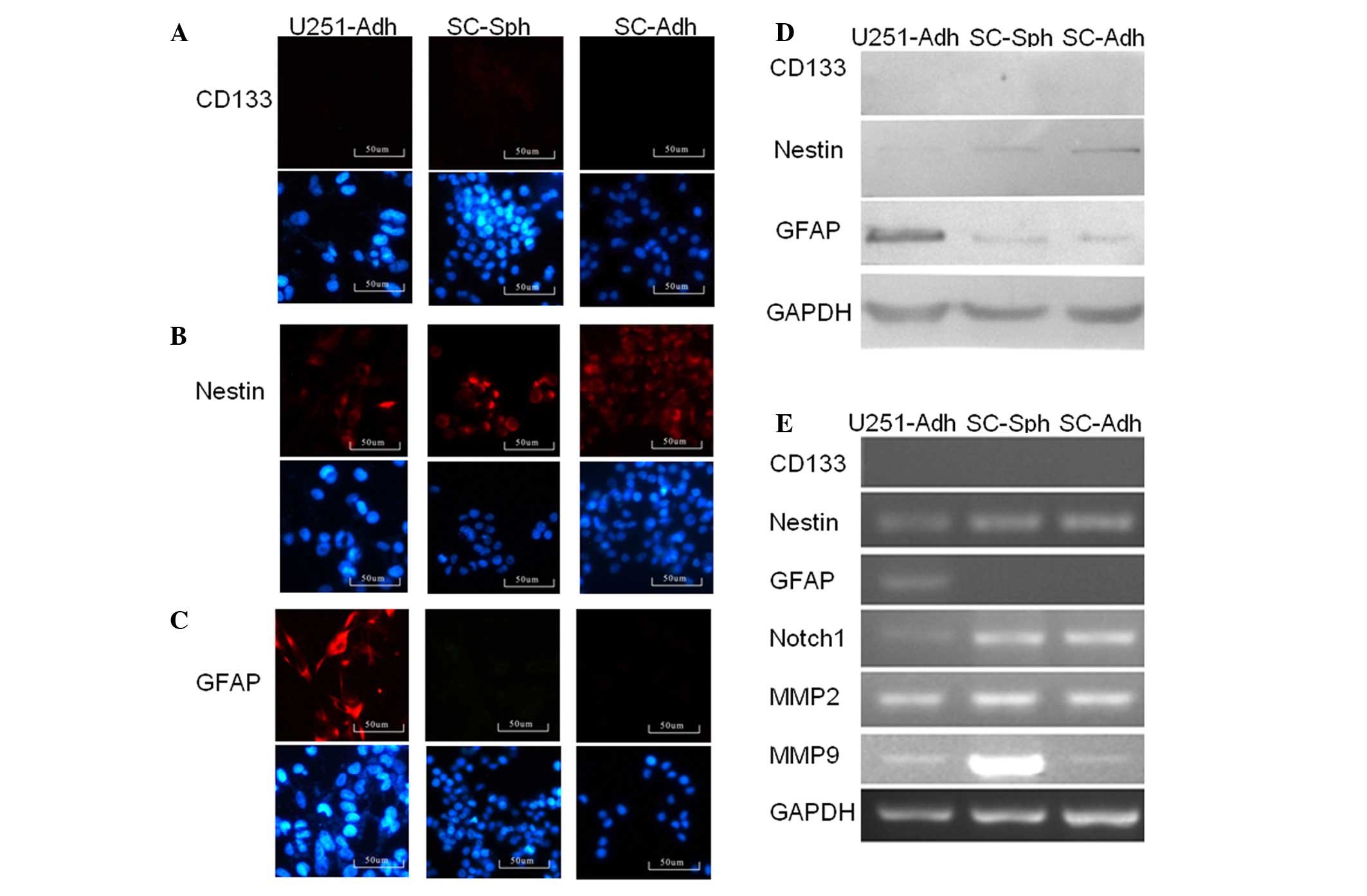 Identification of U251 glioma stem cells and their heterogeneous stem ...