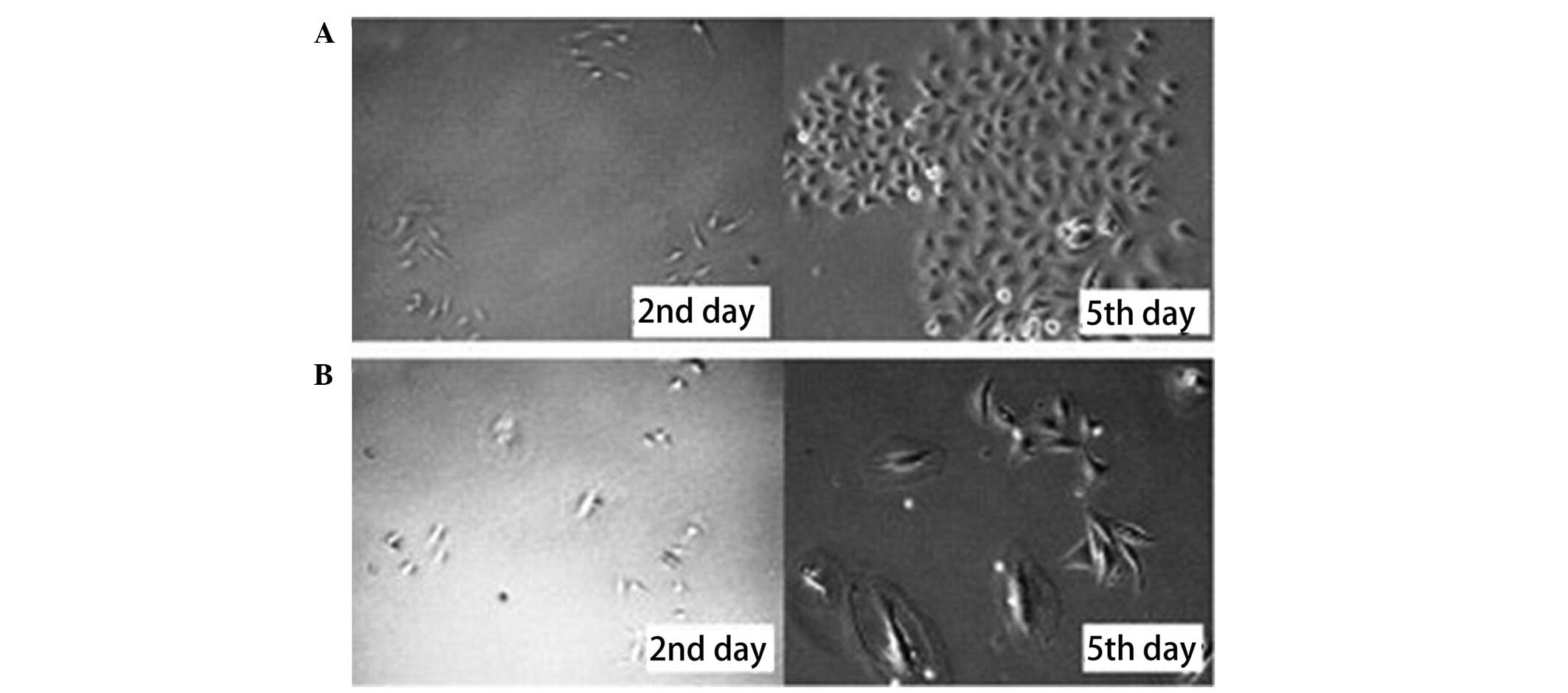 Identification of a cancer stem cell‑like side population in the HeLa ...